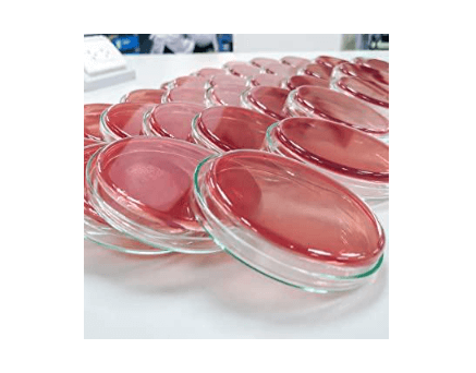 Understanding Urinalysis and Urine Microscopy & Culture - SYNLAB Nigeria