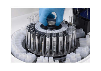 Laboratory Analysis of Urine Microscopy and Culture - SYNLAB Nigeria