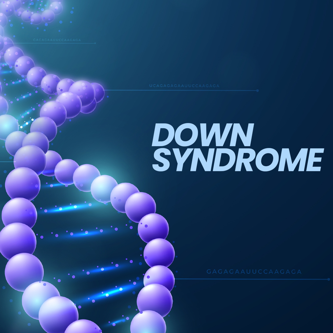 Down Syndrome Explained - SYNLAB Nigeria